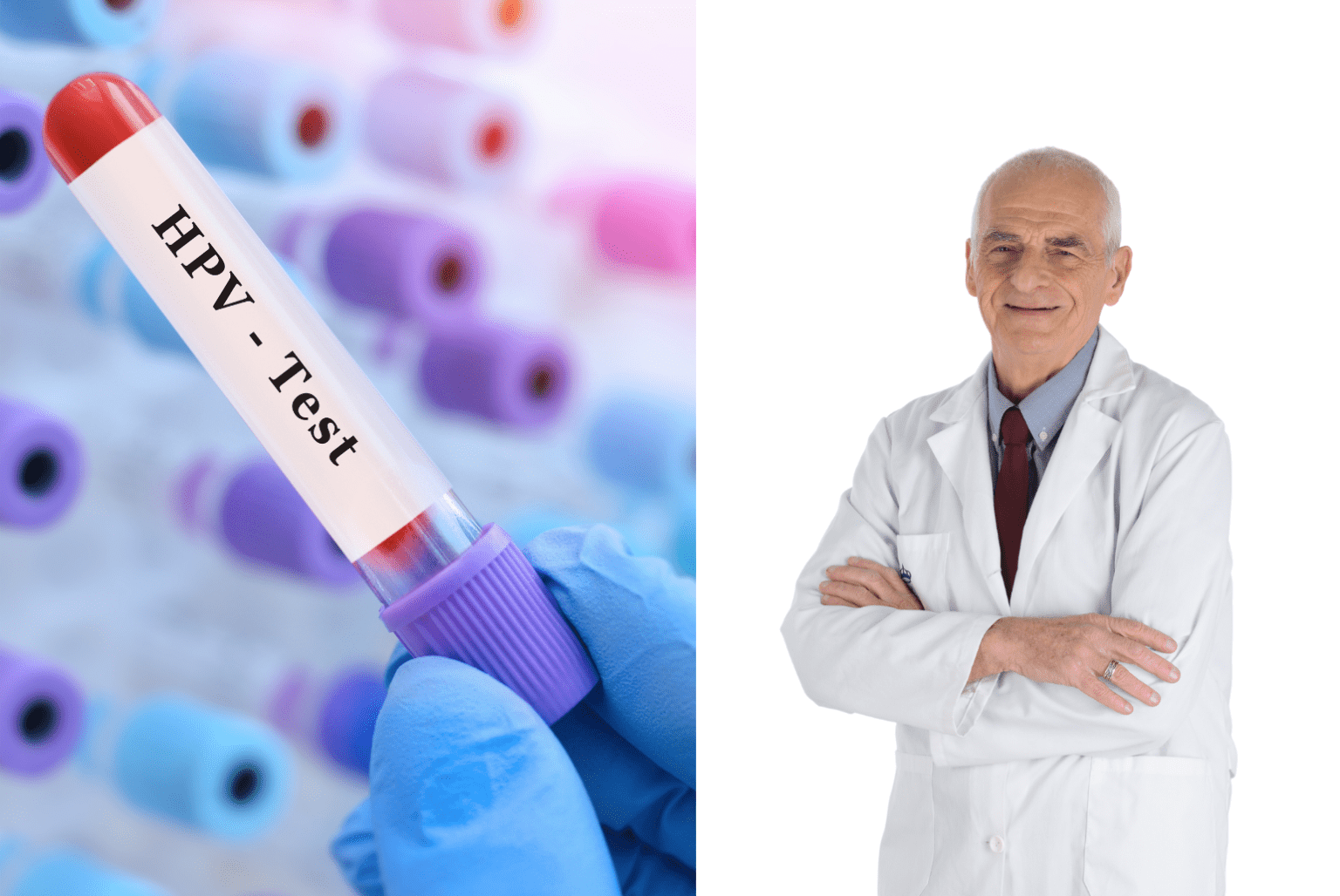 Virus del papiloma humano (VPH) y sus implicaciones